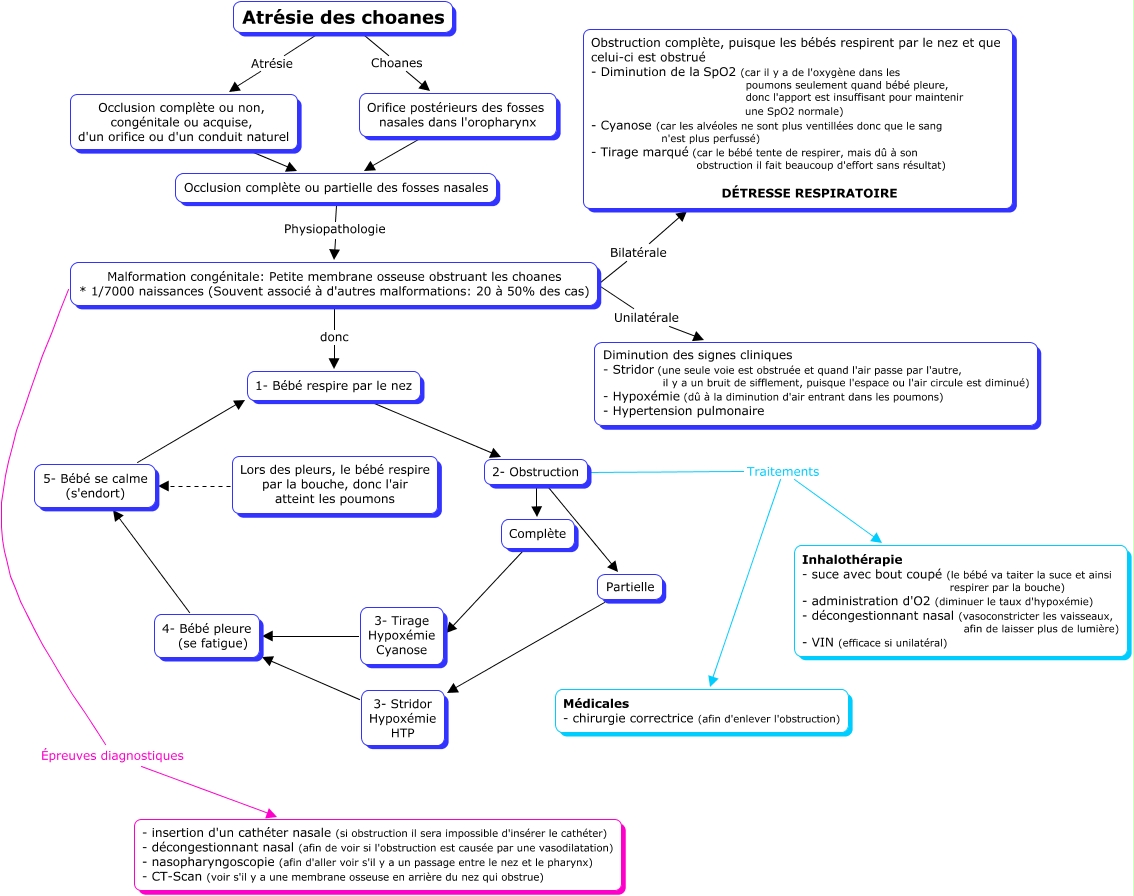 Atrésie des choanes 2