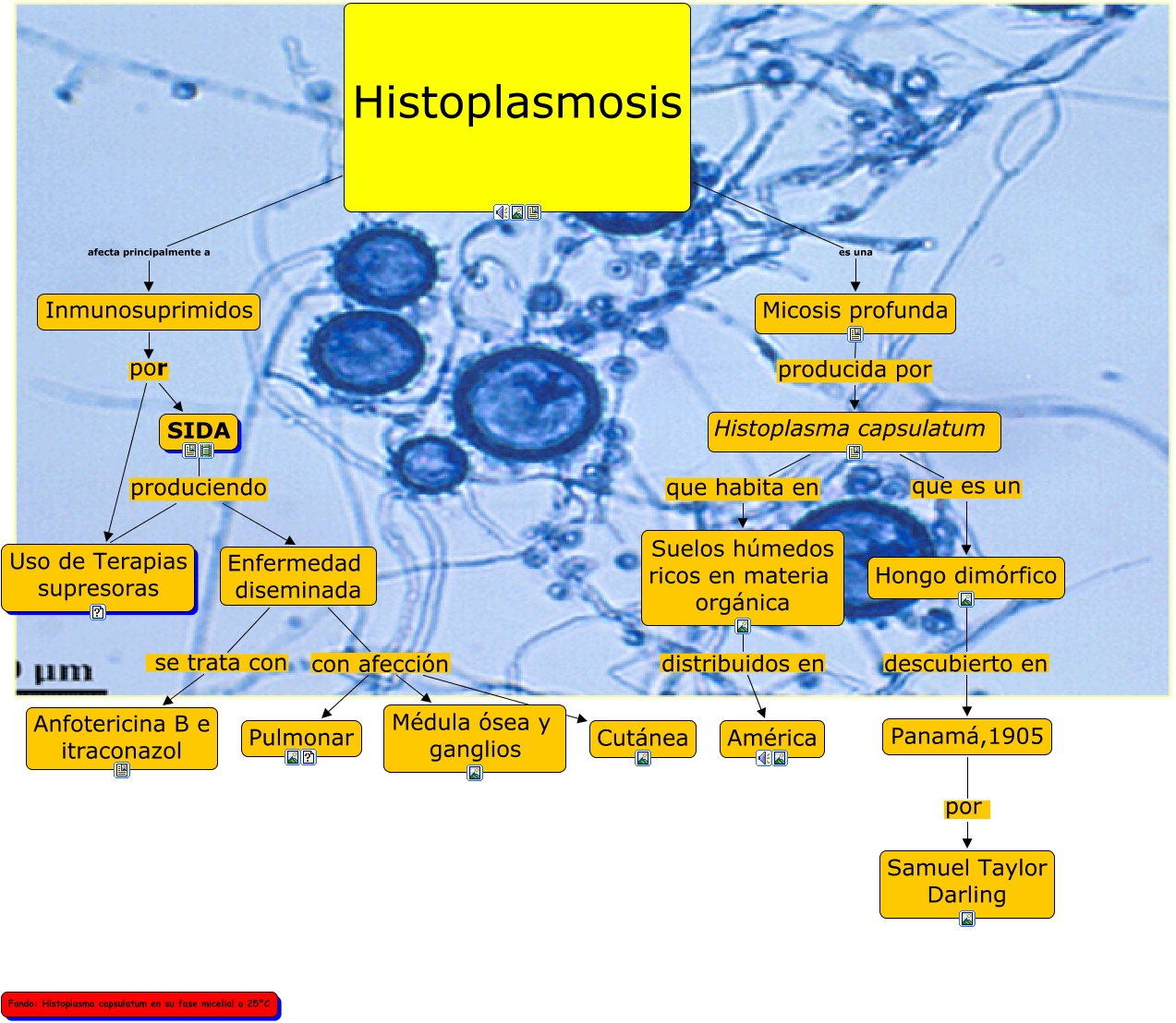 Histoplasmosis_proyecto final - ¿Qué es la Histoplasmosis?