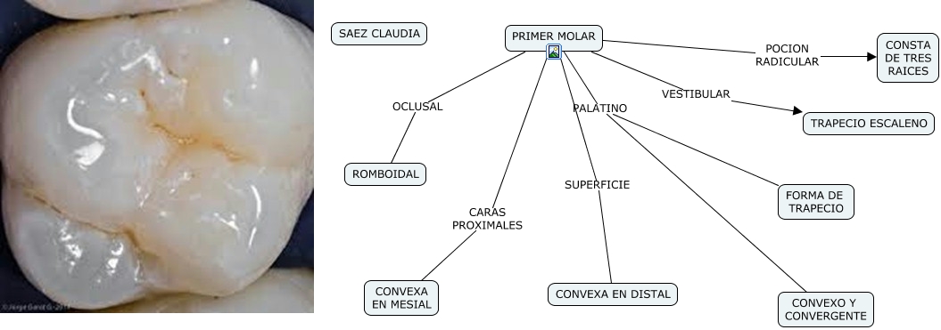 PRIMER MOLAR SUPERIOR